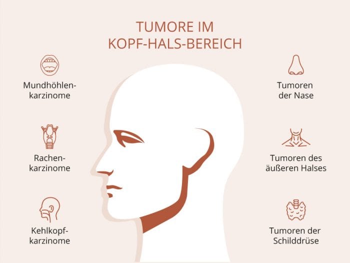 HNO Krebsvorsorge Frankfurt | Praxisklinik Goethe10